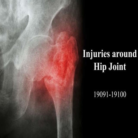 Hip joint anatomy | PPT