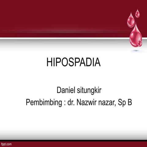 Hipospadia hdjkshajbdjksbjkhqfjgdjksabjkfbjhdgsajhvfjh | PPTX