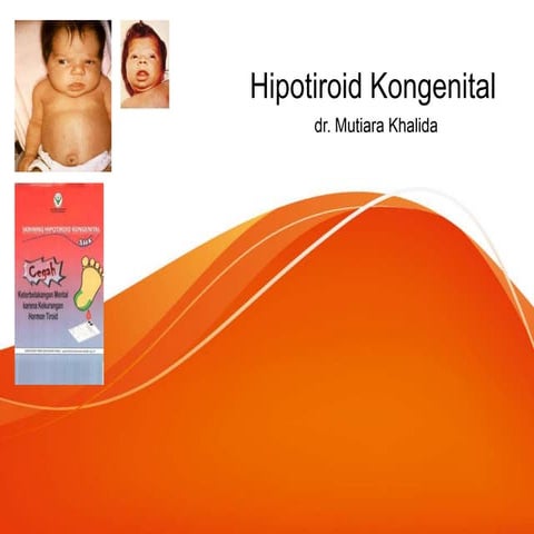 Hipotiroid_Kongenital_Pelatihan_SHK_fini.pptx