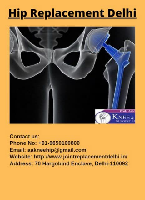 Knee Replacement Surgeon India | PDF