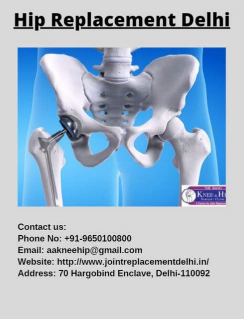 Knee replacement surgeon Delhi | PDF