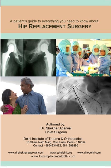 Total hip replacement – a patient guide | PPT | Bone and Joint ...