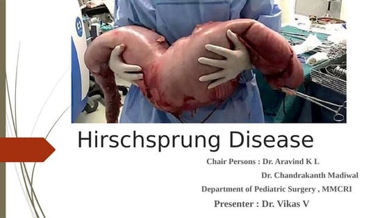 Hirschsprung's disease | PPT