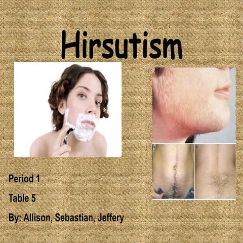 Hirsutism | PPTX