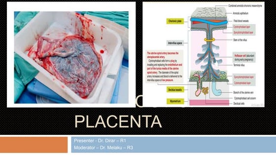 Placenta at term for nursing students | PPTX