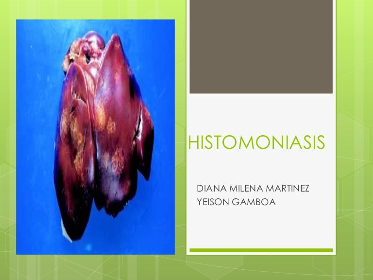 Histomoniasis