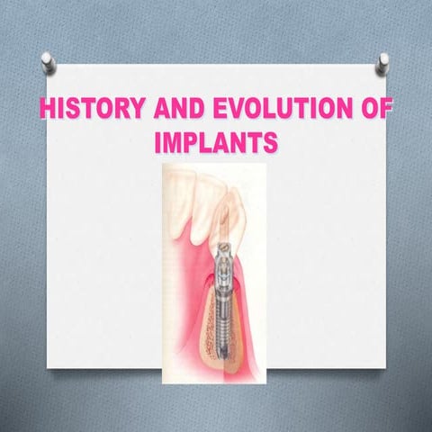 HISTORY AND EVOLUTION OF IMPLANTS1.pptx