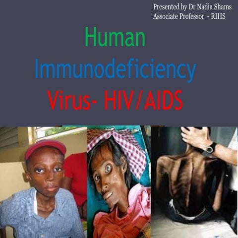 HIV(Human Immunodifficiency Viruses) A-LEVEL Biology PowerPoint | PPTX