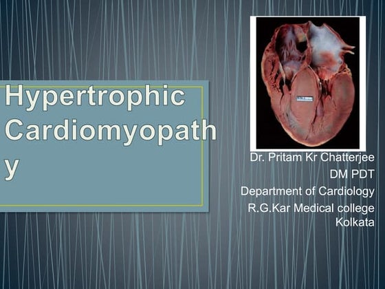 Hypertrophic Cardiomyopathy | PPT