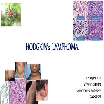 HODGKIN’S LYMPHOMA.pptx