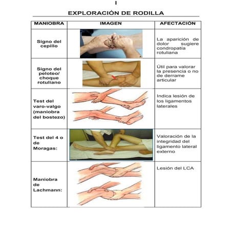 Maniobras en la exploración de rodilla | PPTX
