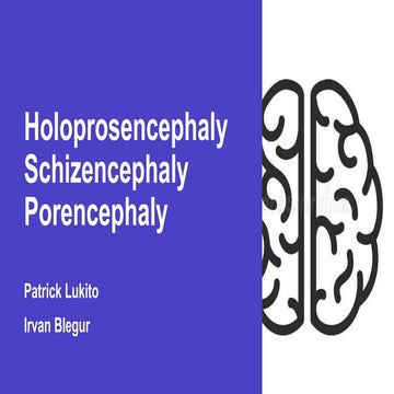 holoprosencephaly definition classification.pptx