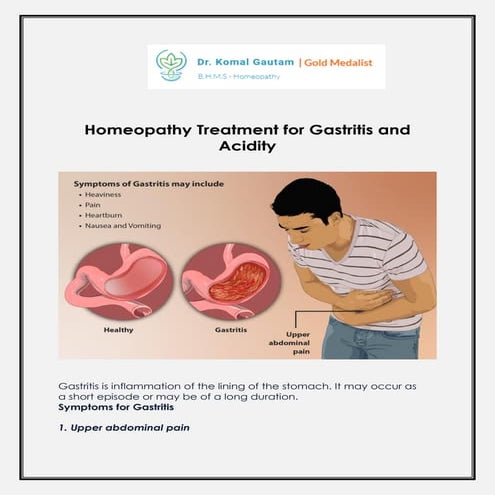 Homeopathy Treatment for Gastritis and Acidity | PDF