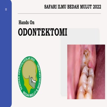 HO Odontektomi-1.pptx