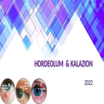 HORDEOLUM DAN KALAZION Tumor palpebra ppt.pptx