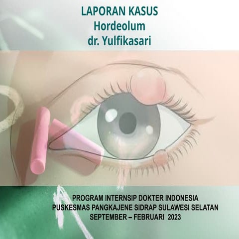 Hordeolum Lapsus PKM pangkajenne sidrap .pptx