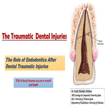 horizontal fracture .pdf