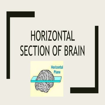 Horizontal section of brain.pptx