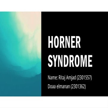 Horner syndrome copy copy.pptx…………………….. | PPTX