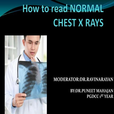 How to read normal x ray | PPTX