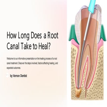 Root Canal Healing Time | PDF