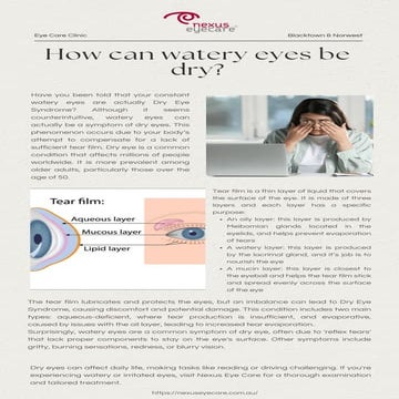 How can watery eyes be dry ? - Nexus Eye Care | PDF