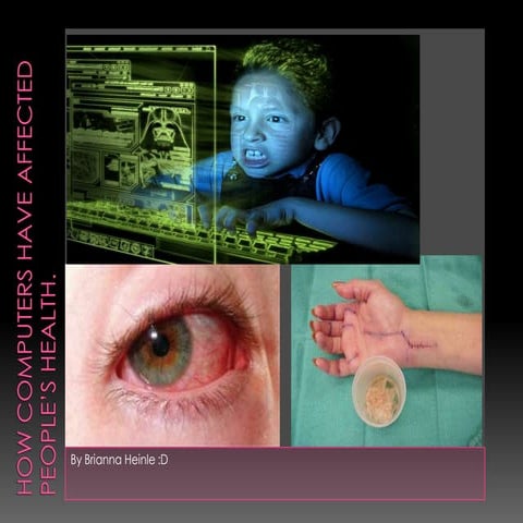 How computers have affected people’s health | PPT