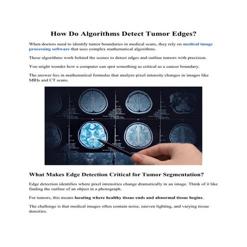 How Do Algorithms Detect Tumor Edges.pdf