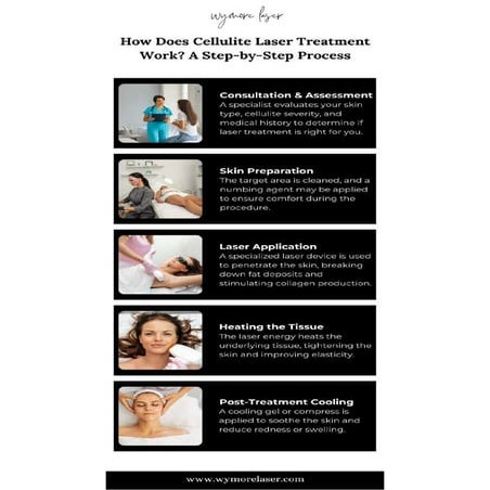 Transform Your Skin with Cellulite Laser Treatment at Wymore Laser | PDF