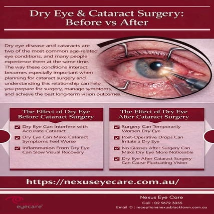 How Dry Eye Can Affect Cataract Surgery – Before and After | PDF