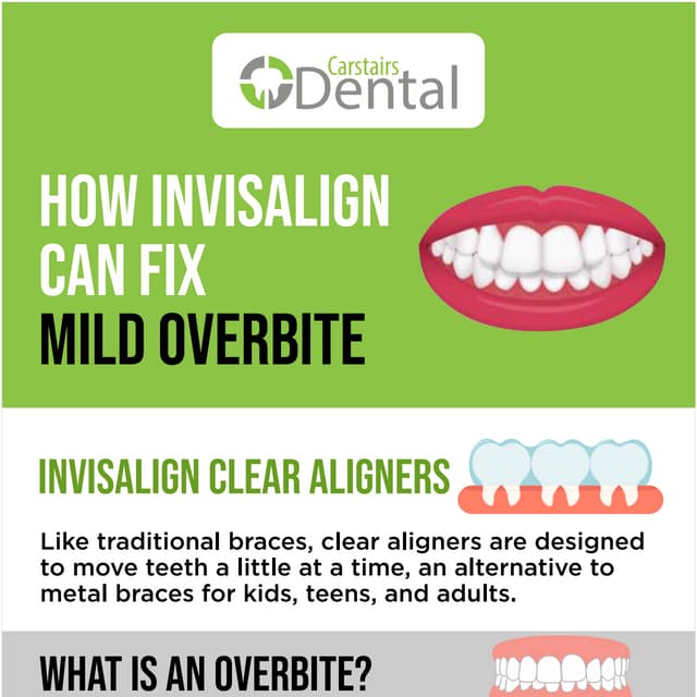 How Invisalign Can Fix Mild Overbite.pdf