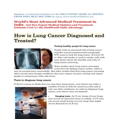 Treatment options for lung cancer | PPTX