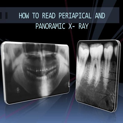 Anatomical landmarks in Periapical and Orthopantomogram X-ray | PPTX
