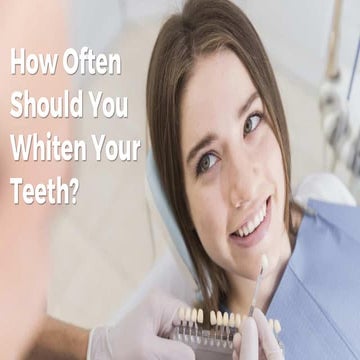 How often should you whiten your teeth | PDF