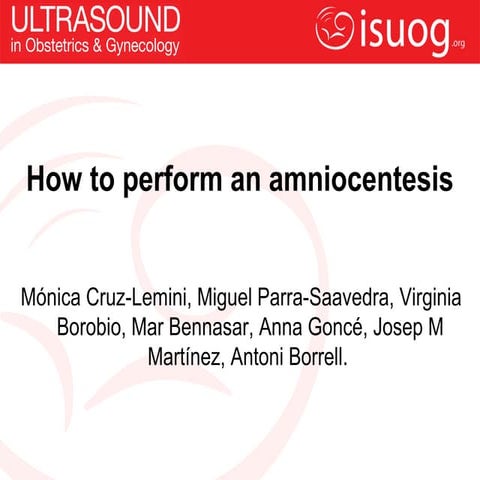 How to perform an amniocentesis | PPT | Pregnancy | Reproductive Health