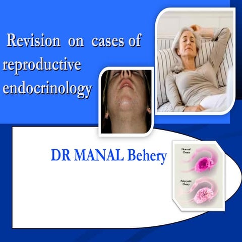 revision on cases of reproductive endocrinology | PPT