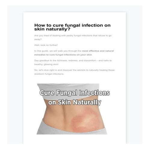 How to cure fungal infection on skin naturally.pdf