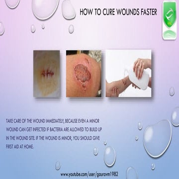 How To Cure Wounds Faster | PPT