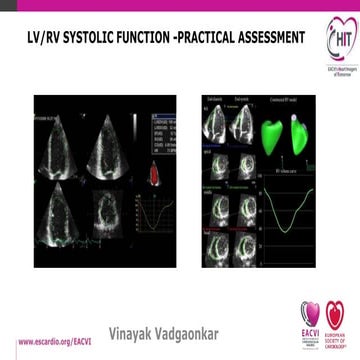 How to echo series...LV systolic function-practical assessment | PPTX