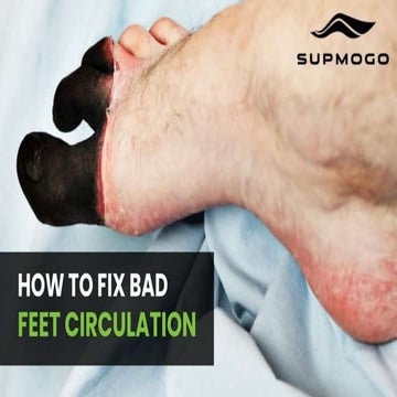 How to Fix Bad Feet Circulation: Supmogo Blogs | PPTX