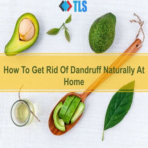 How To Get Rid Of Dandruff Naturally At Home | PPTX