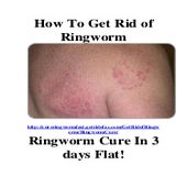 How to get rid of ringworm