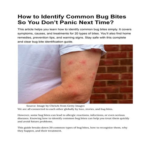 How to Identify Common Bug Bites So You Don’t Panic Next Time_.pdf