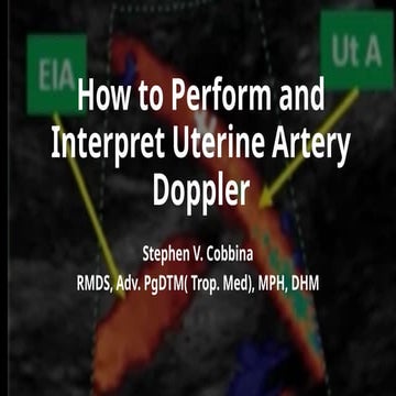 HOW TO PERFORM AND INTERPRET UTERINE ARTERY DOPPLER copy.pptx