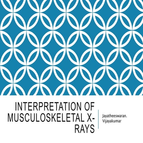 Interpretation of Musculoskeletal X-Ray | PPTX