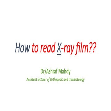 How to read X-ray film.pptx