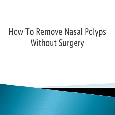 How To Remove Nasal Polyps Naturally Without Surgery | PPTX