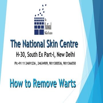 How to remove warts | PPT