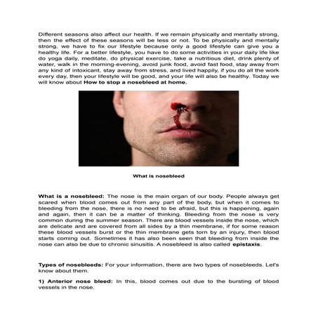 How to stop a nose bleed at home.pdf