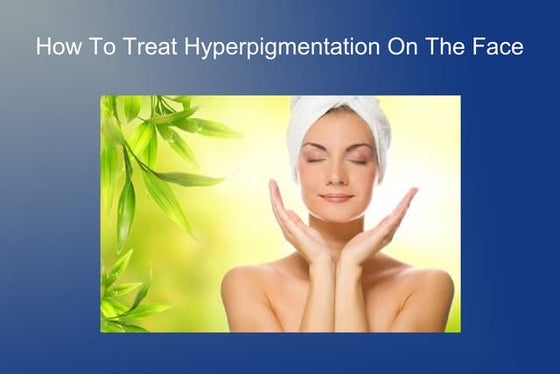 Hyperpigmentation presentations